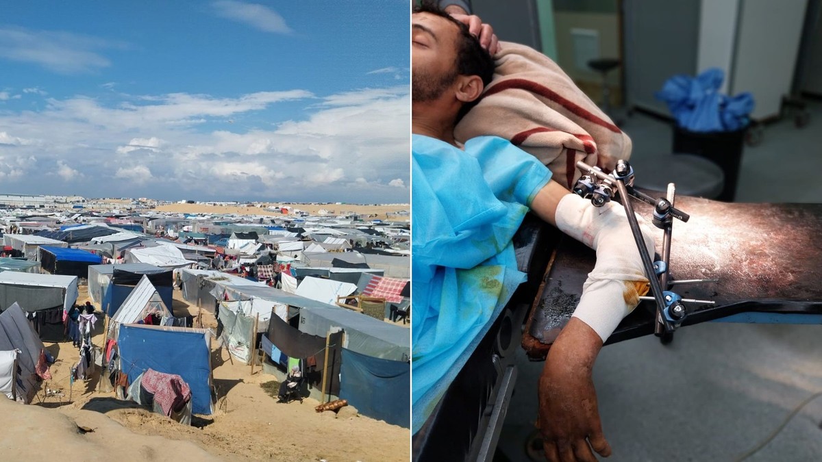 Gaza: «On a dû l’amputer des deux jambes, je n'oublierai pas»