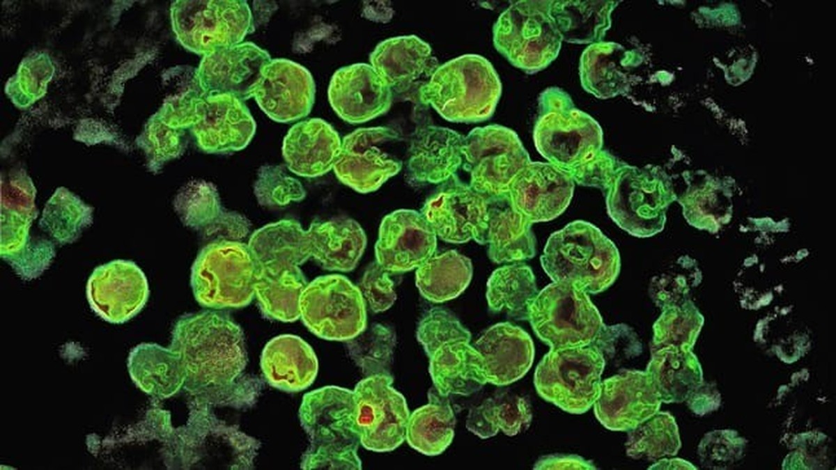 Une amibe «mangeuse de cerveau» tue un jeune homme