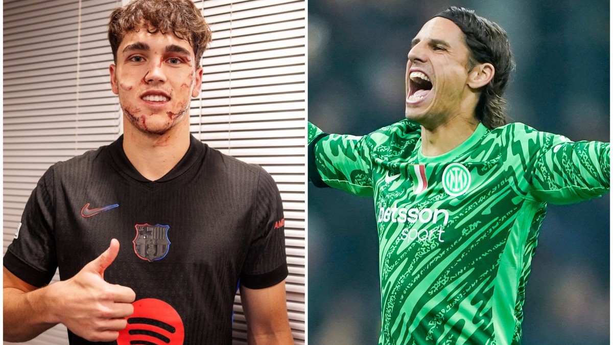 Champions League: Barça-Cubarsi schockt mit blutverschmiertem Gesicht