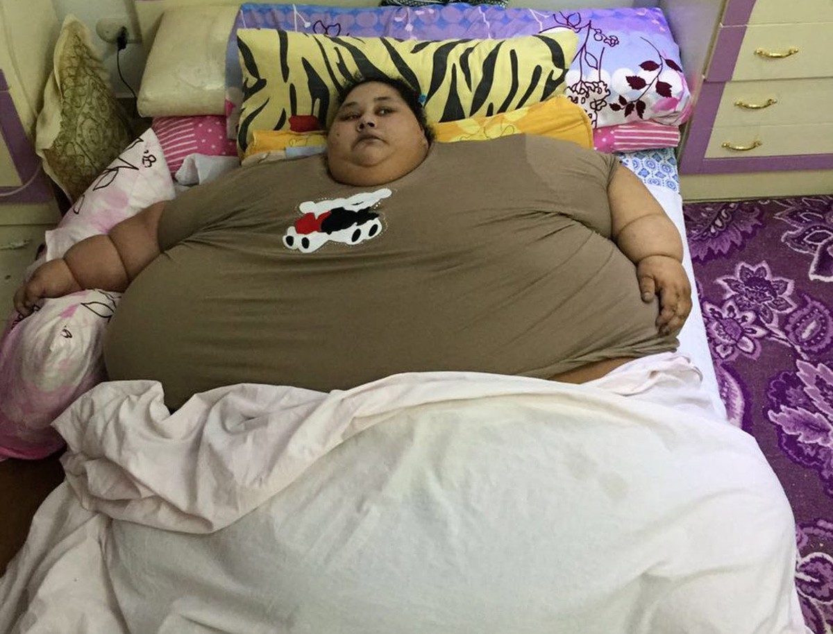 Ehemals dickste Frau der Welt nach Abu Dhabi verlegt – in 3 Monaten verlor sie 323 Kilo