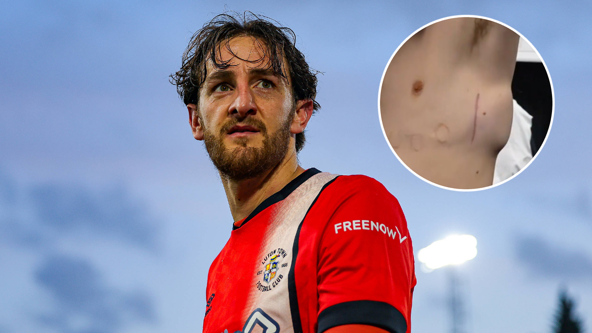 Luton-Captain Lockyer spricht über Kollaps – und zeigt Defibrillator