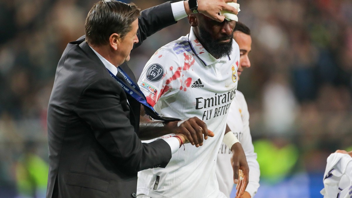 Champions League: Antonio Rüdiger als blutiger Held – die Highlights