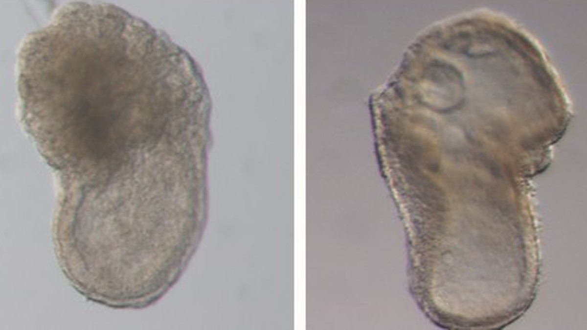 Forscher züchten erstmals künstlichen Embryo