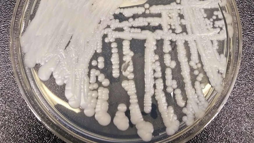 Tödlicher Hefepilz – warum Candida auris so gefährlich ist
