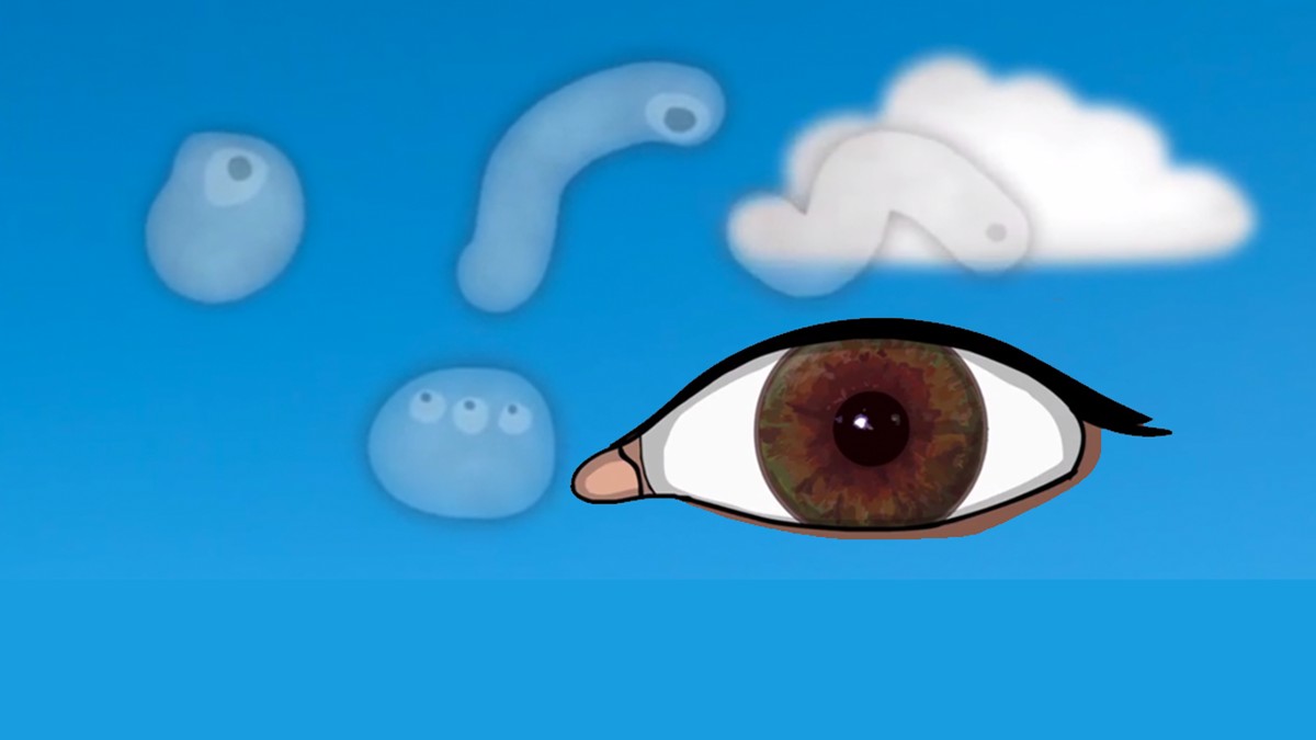 Hast du auch Würmer vor den Augen, wenn du in den Himmel schaust? Hier ...